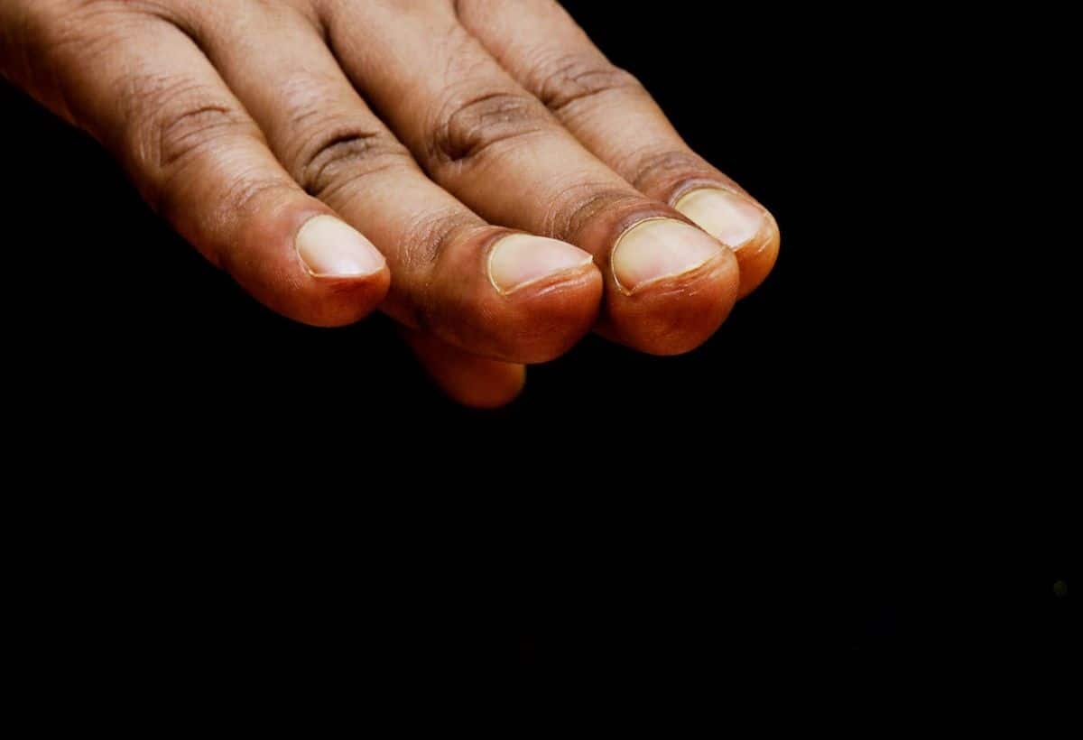 Nail Signs: नाखून से पता चल जाएगा सेहत का राज, रंग-बनावट से करें बीमारी ...