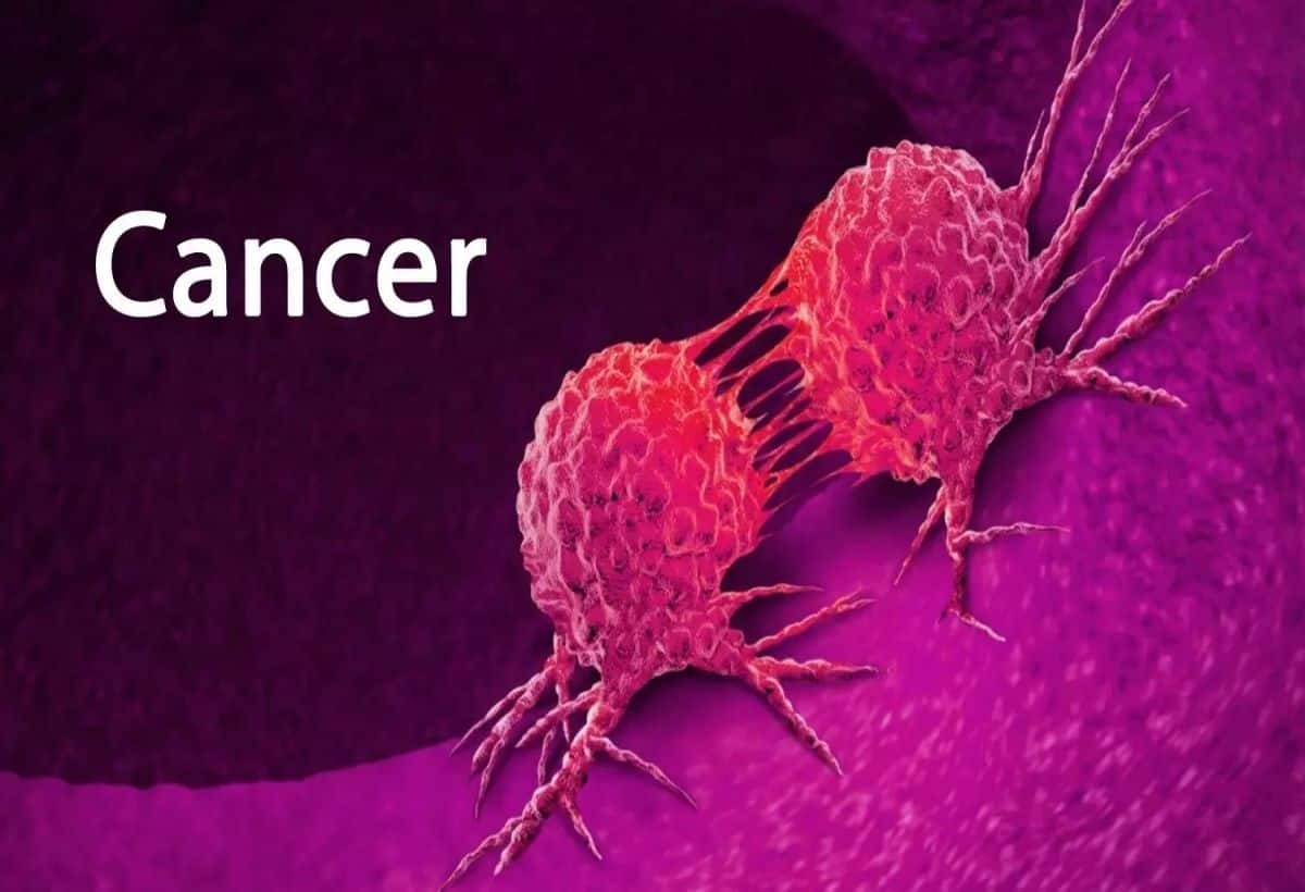 Cancer: शरीर में बनी हर गांठ कैंसर नहीं होती, कैंसर गांठ के बारे में ...