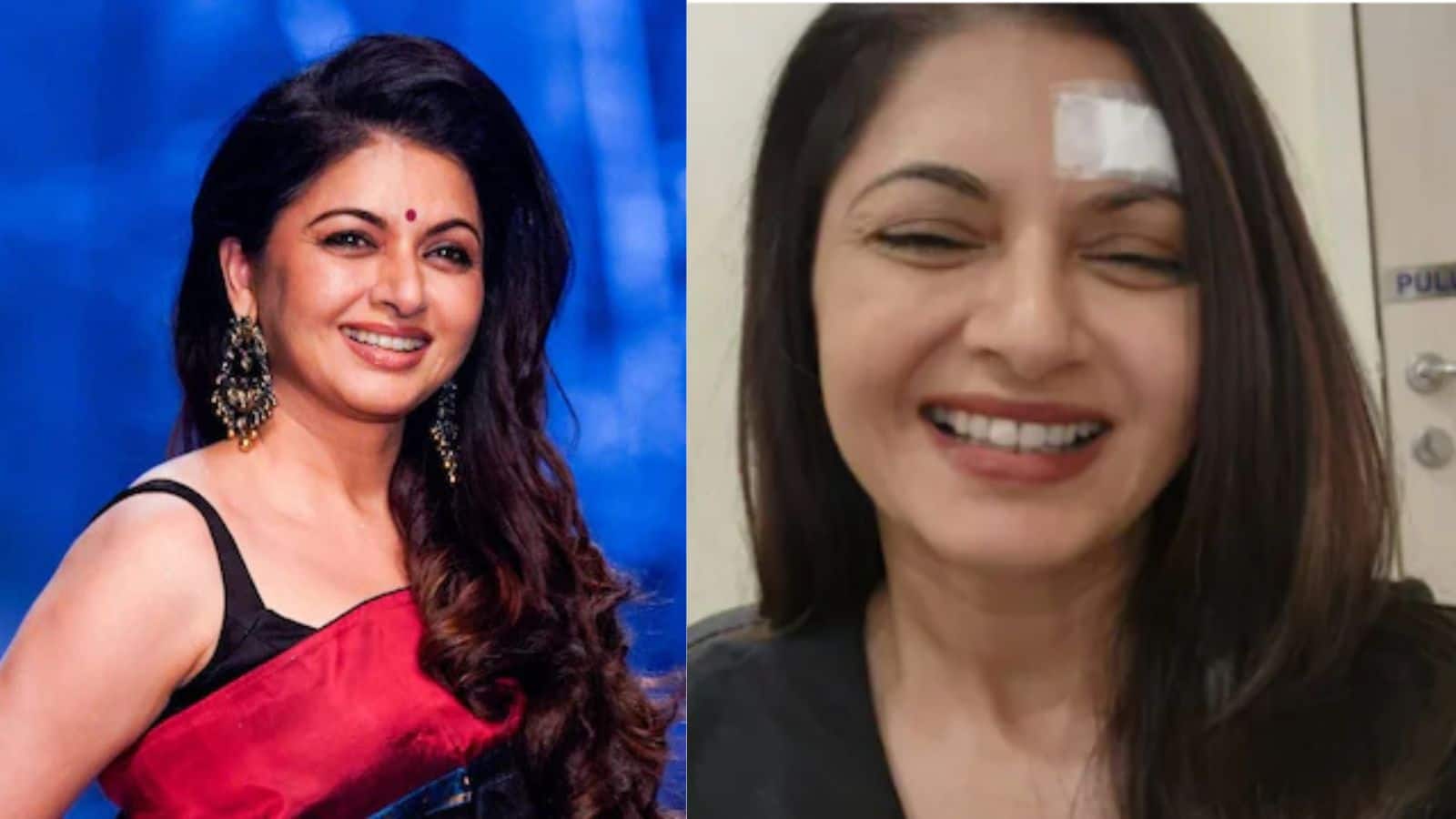 Bhagyashree Injury: पिकलबॉल खेलते समय भाग्यश्री के साथ हुआ बड़ा हादसा, सर्जरी के बाद लगे इतने ...