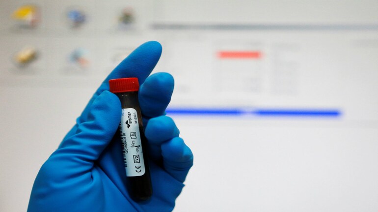 Punjab government to spend Rs 25 crore on dope tests of four lakh employees