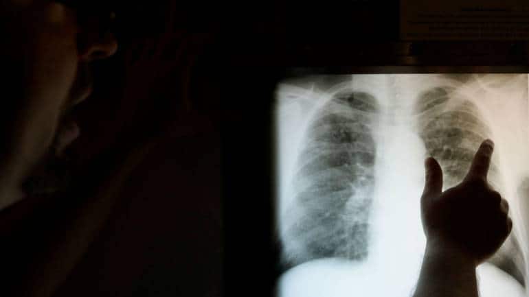 Scientists perform world's first 3D, colour X-ray on human body