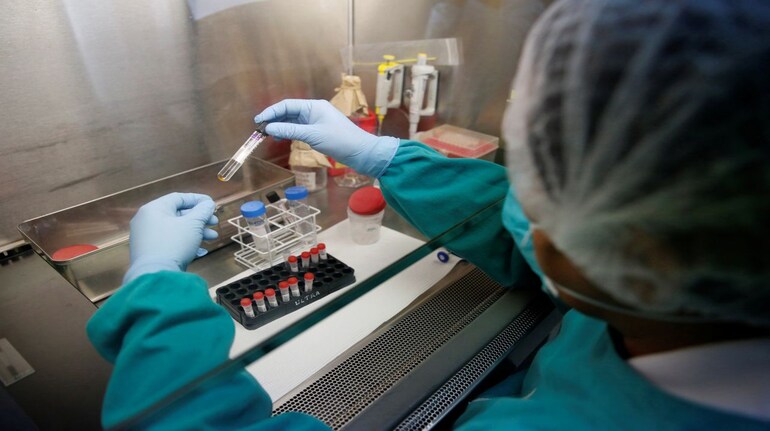 India now has most comprehensive TB test; can check sensitivity to 18 ...
