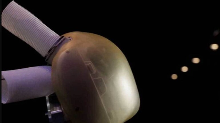 French firm makes first commercial implant of artificial heart: All you ...