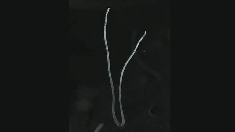 Scientists discover world’s largest bacteria, the first to be visible ...