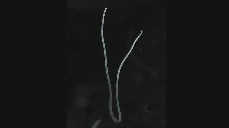 Scientists discover world’s largest bacteria, the first to be visible ...