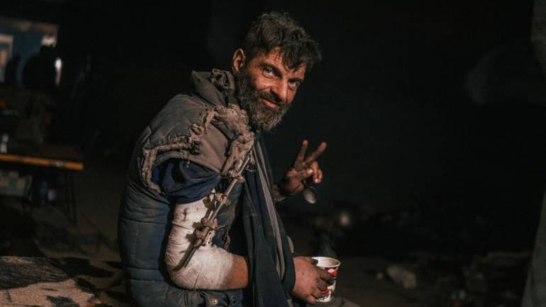 Haunting photos show Ukraine fighter before and after being taken captive