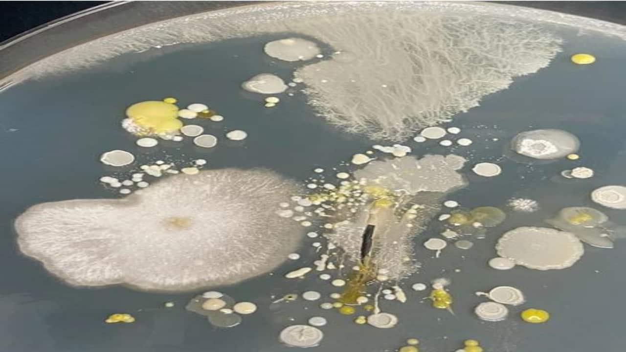 TikToker creates jewellery using bacteria from her own body