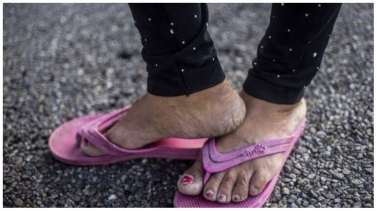 Hyderabad woman's shoe size increased from 5 to 7 over two years ...