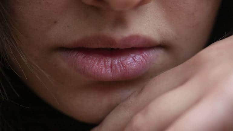 Are your lips turning dark? Try these expert-approved home remedies ...