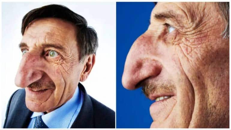 Mehmet Ozyurek, Guinness record holder for world's longest nose, dies at 75