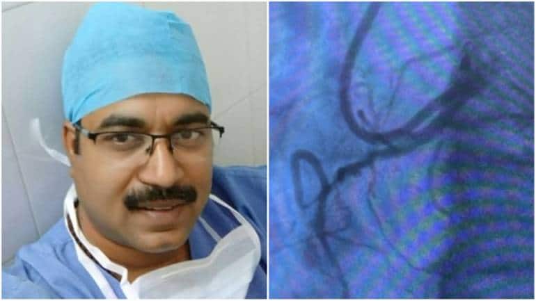 Bengaluru man treats chest pain as indigestion, it was a heart attack ...