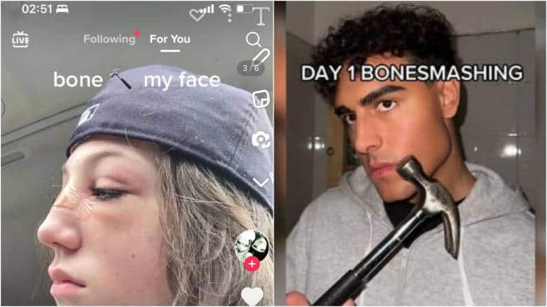 'Bone smashing' trend takes over TikTok. What is it?