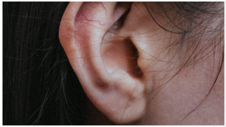 Woman had rustling sounds in ear for 4 days, doctors find spider ...
