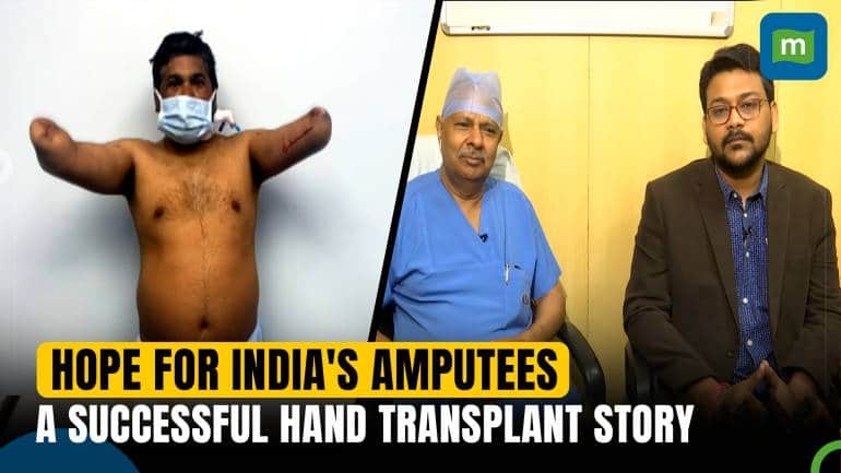 A ray of hope for India's amputees: A story of successful hand ...