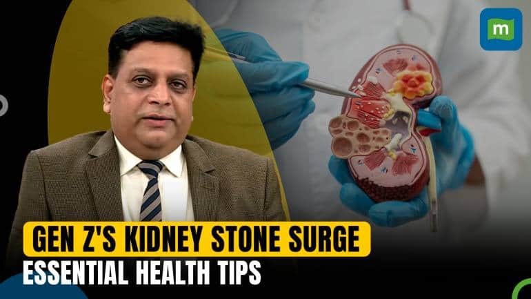 Kidney Stone Cases Among Gen Z | Essential Kidney Health Tips & Advice ...