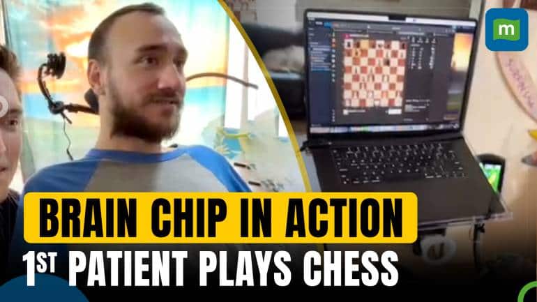 Elon Musk’s Neuralink Shares Video Of First Brain-Chip Patient Playing ...