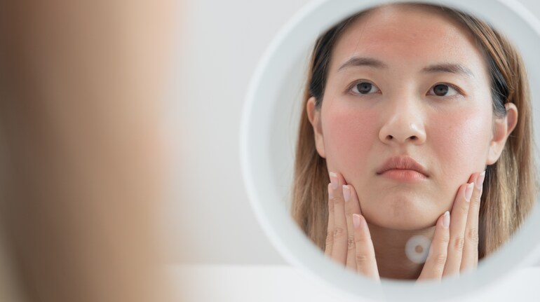 Natural remedies for hyperpigmentation: Lighten skin with these ...