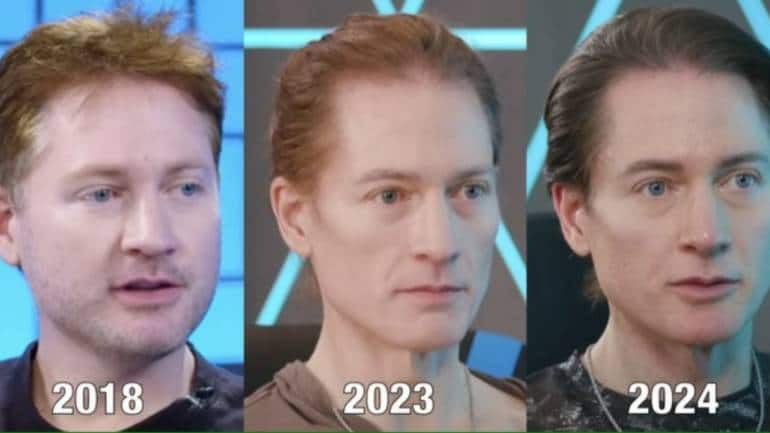Age-reversing millionaire shares pics of his transformation over 6 ...