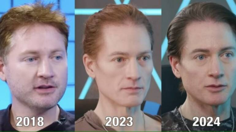 Age-reversing millionaire shares pics of his transformation over 6 ...