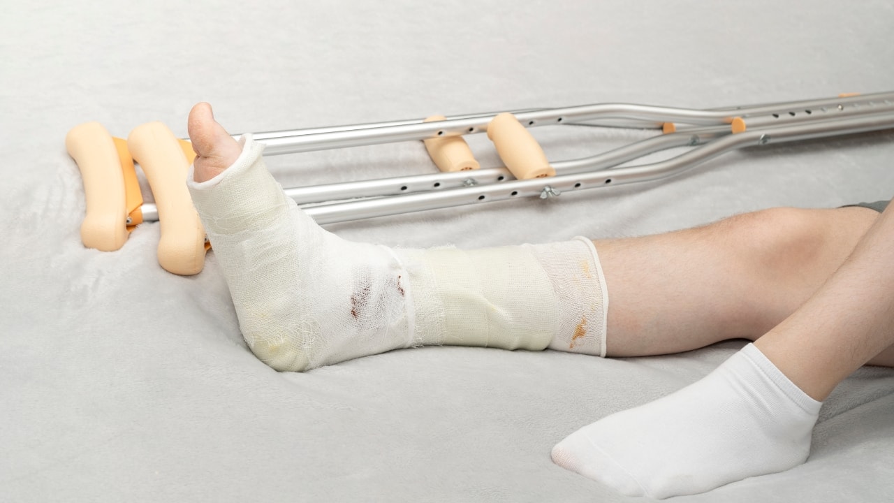 Nutritional deficiencies: 8 signs and symptoms to watch out for and how ...