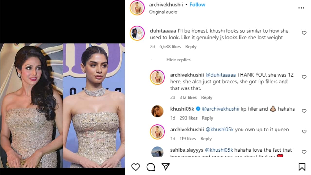 Khushi Kapoor confesses to nose job and lip fillers as she reacts to ...