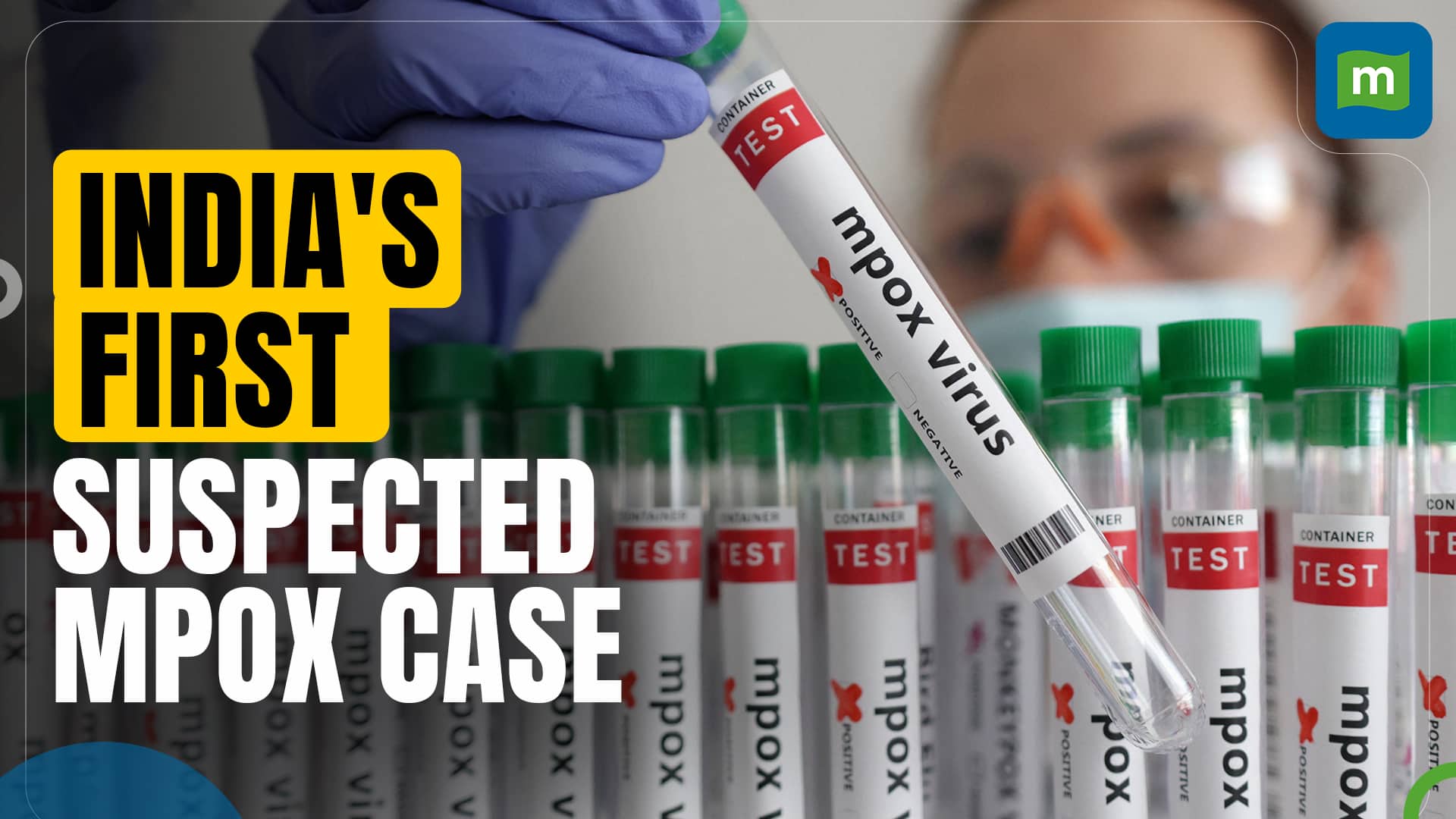 India reports first suspected Mpox case, Patient isolated | Health ...
