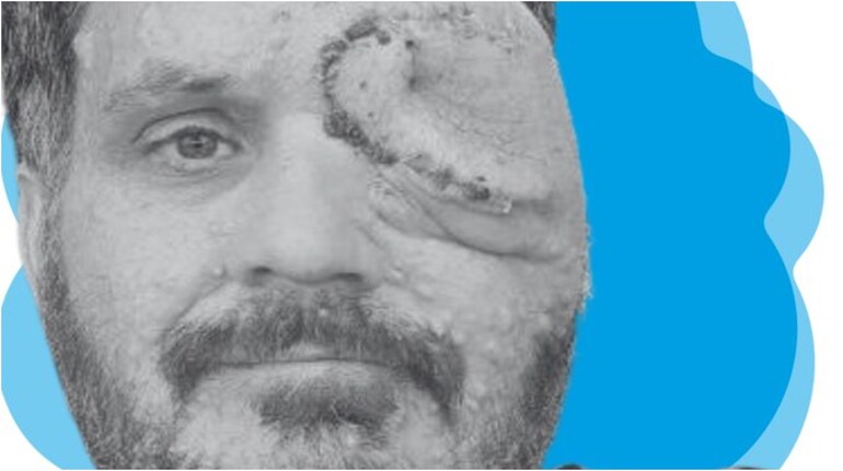 'They told me I was scaring customers': Man with facial condition asked ...