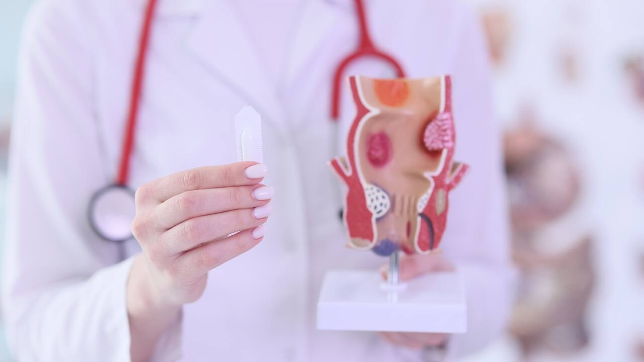 What are Haemorrhoids (piles)? Signs, stages & how to treat them ...