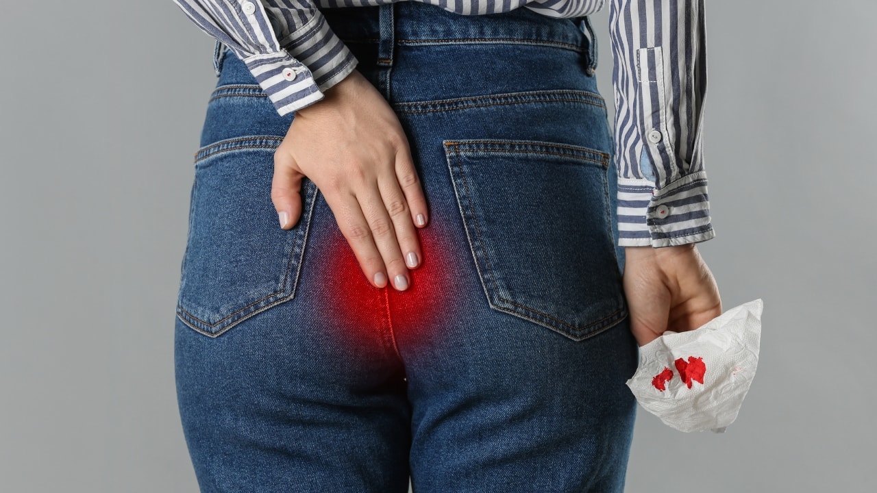 What are Haemorrhoids (piles)? Signs, stages & how to treat them ...