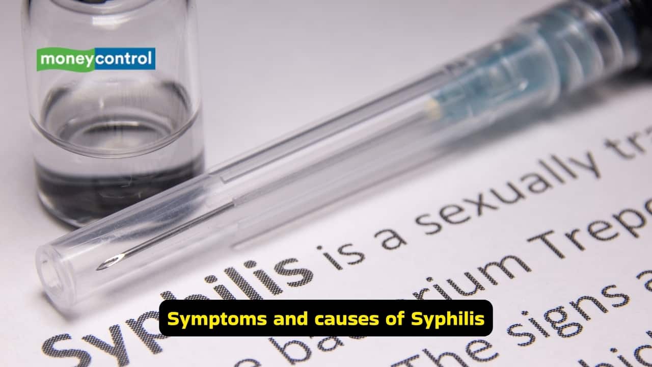 Everything you need to know about syphilis: Causes, symptoms ...