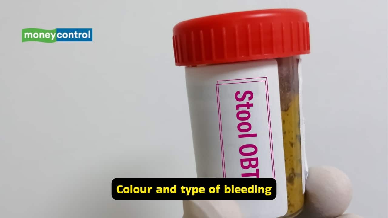 Causes of blood in stool: It could be fissures, haemorrhoids, ulcers ...