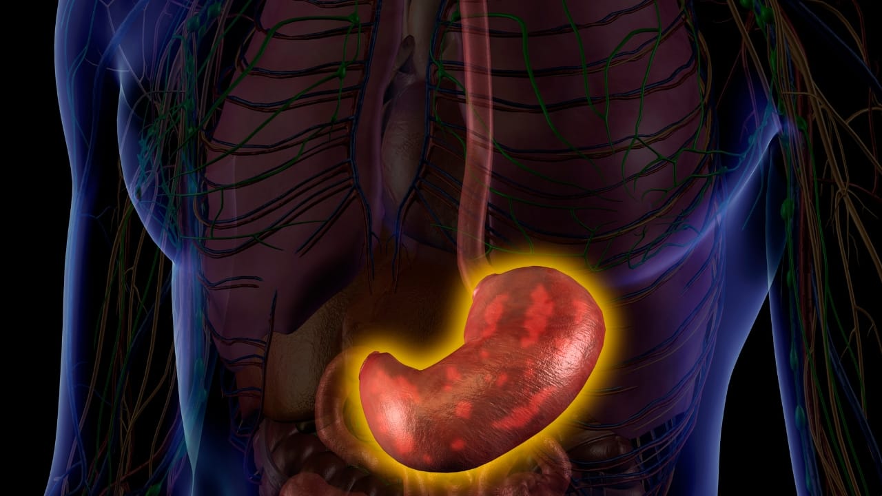 Understanding Gastro-Oesophageal Reflux Disease