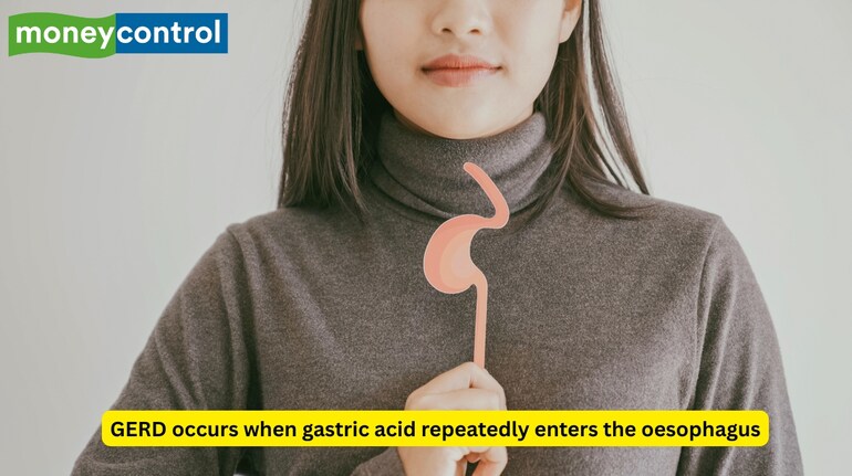 Understanding Gastro-Oesophageal Reflux Disease