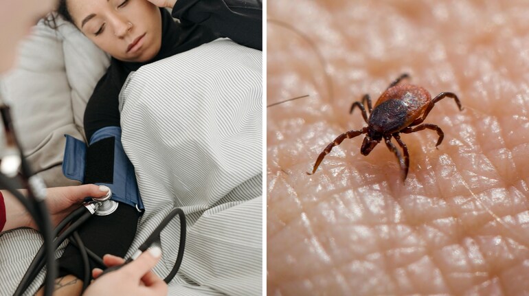 Scrub Typhus cases surge in Andhra Pradesh: Symptoms, risks and ...