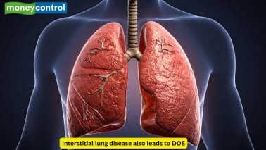 Dyspnea on exertion: All about this condition and causes that lead to ...