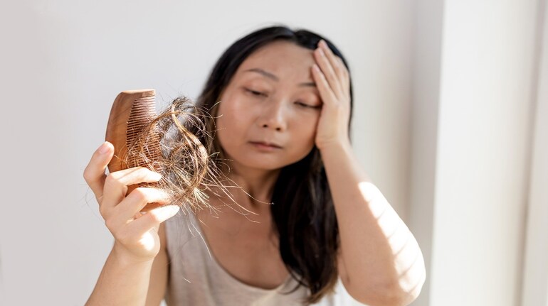 Building a Hair-Friendly Diet: Nutrients You Need Every Day