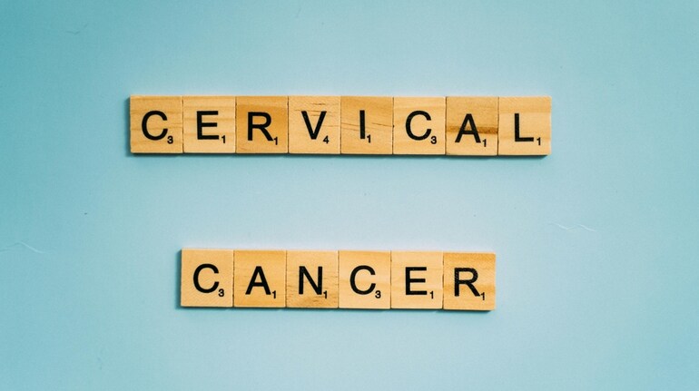 Why cervical health is important even if you have no symptoms