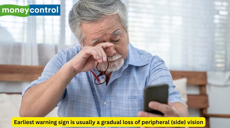 Doctor shares early warning signs of glaucoma you should not ignore