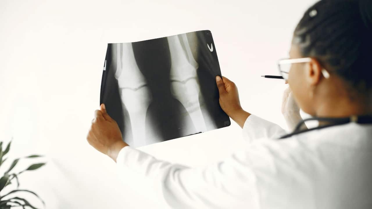 Scientists discover protein that could prevent bone loss without exercise
