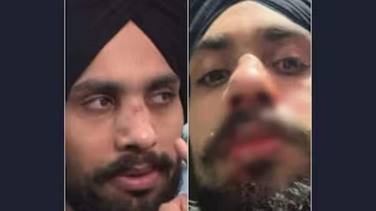 'They called me an Indian dog’: Sikh nurse injured in racial attack in ...