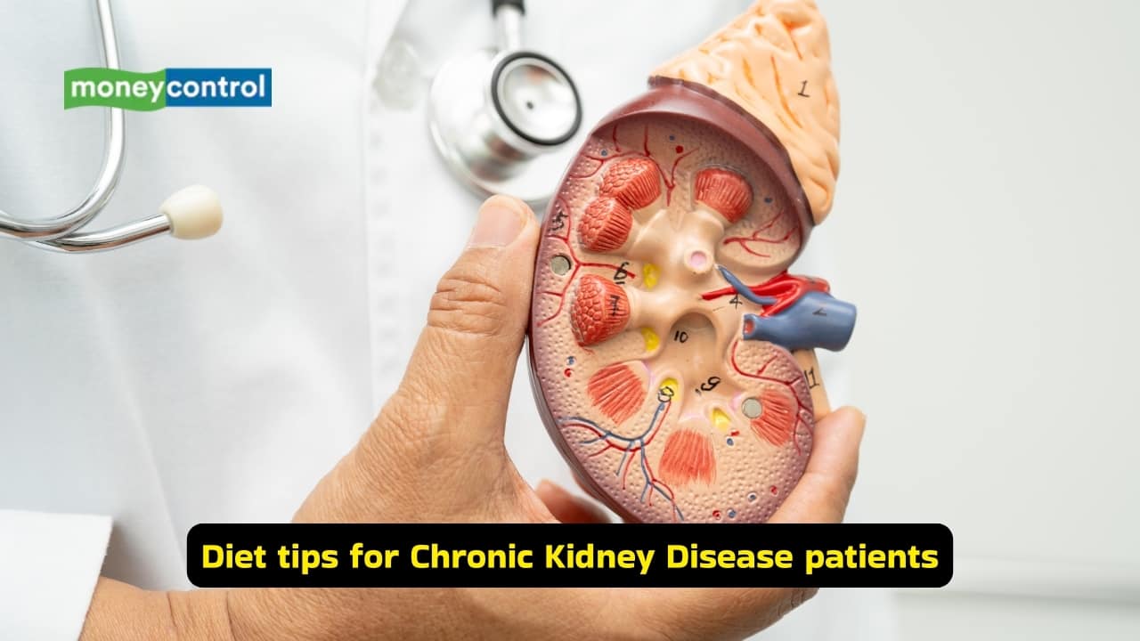 World Kidney Day 2026: From proteins to potassium, follow these easy ...