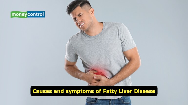 1.8 billion cases of fatty liver disease in the world by 2050, warns ...