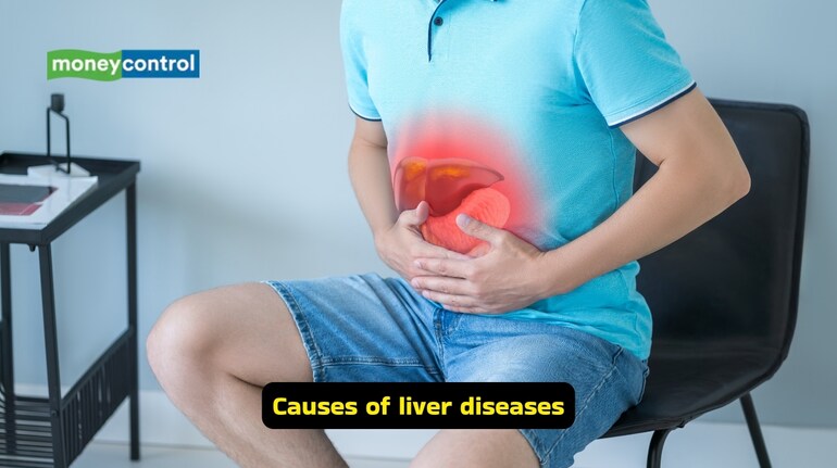 World Liver Day 2026: Top Pune gastroenterologist explains causes ...