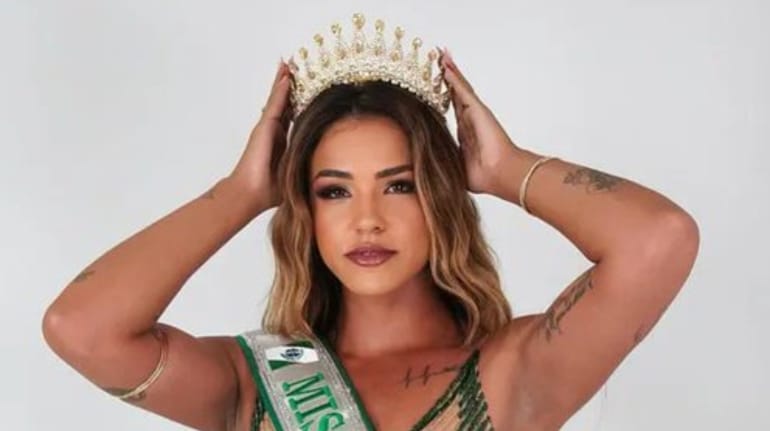 Brazilian model dies at 31 from suspected inflammatory heart disease ...