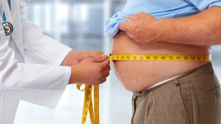 Obesity may speed up Alzheimer’s by disrupting brain immunity, new ...