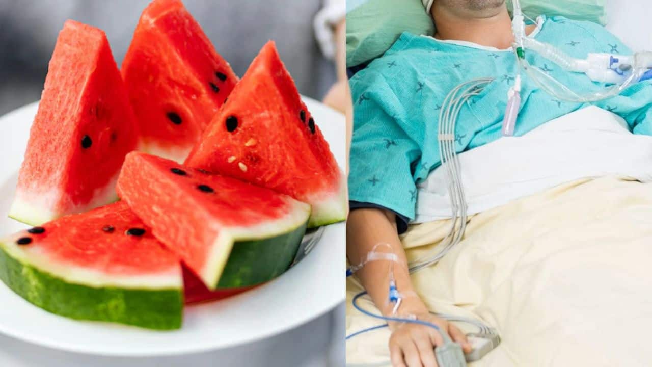 “Another watermelon tragedy”: Man dies, son critical after consuming ...