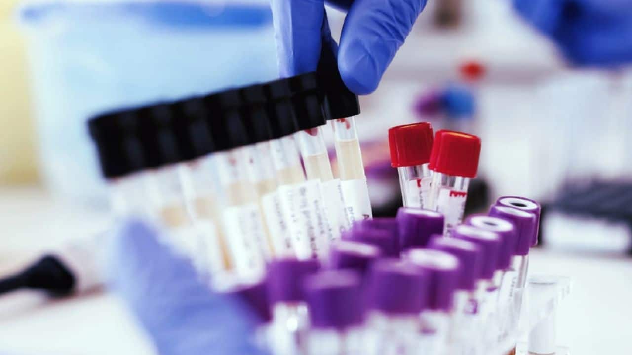 Secret Mephedrone lab busted in South Mumbai flat; Rs 50.74 crore drugs ...