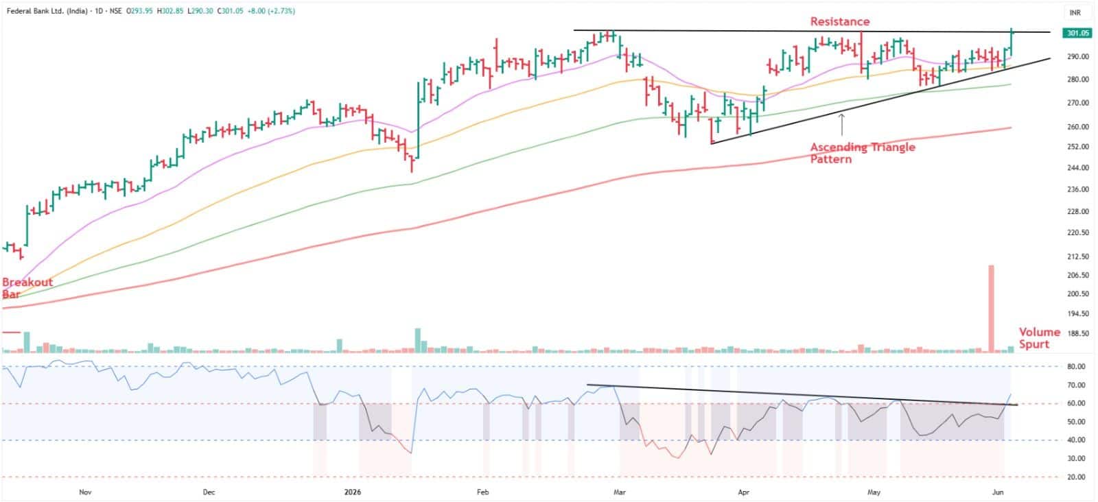 Trade Spotlight: How should you trade Narayana Hrudayalaya, ABB India ...