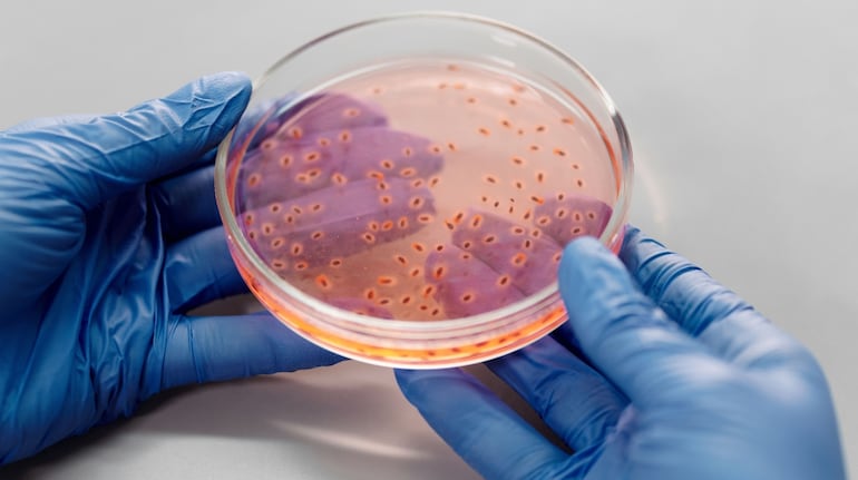 4-year-old Kerala girl dies of Shigella infection, 2 others test ...