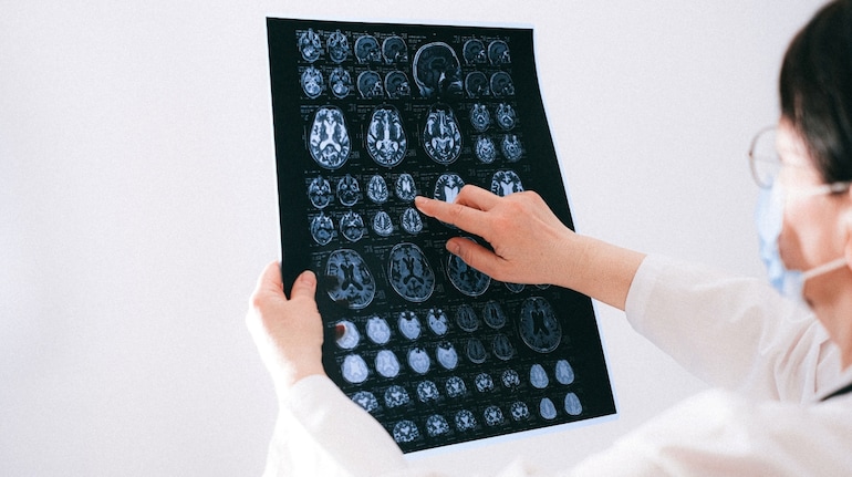 3 symptoms of brain tumour that people often ignore, warns neurologist